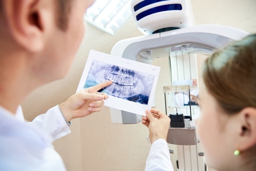 Cone Beam CT Imaging | CBCT | Union City Mini Dental Implants